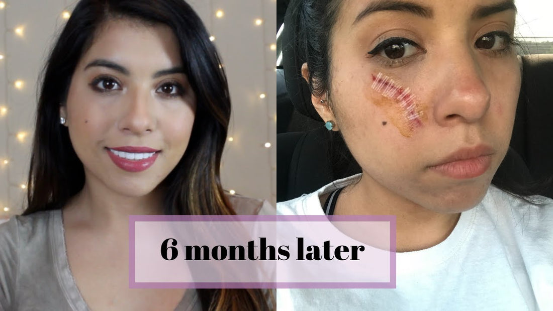 Scarguard Scar Repair Liquid – Scarguard Labs