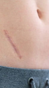 Scarguard Scar Repair Liquid – Scarguard Labs